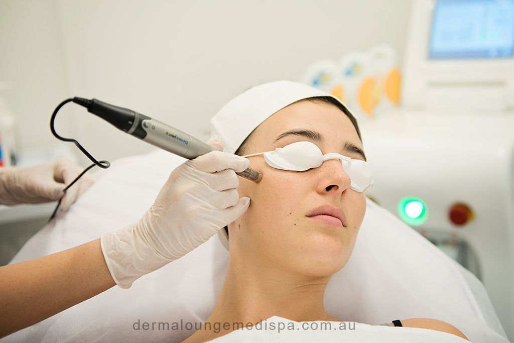 Dermalounge MediSpa - Kenmore | Face treatments | Bookwell